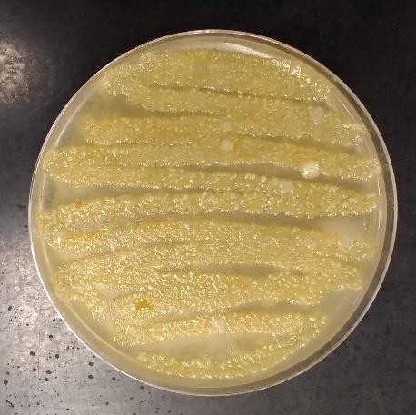 1.12: Streaking for Isolation Assignment - Biology LibreTexts