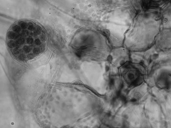 10.4: Ferns (Class Polypodiopsida) - Biology LibreTexts