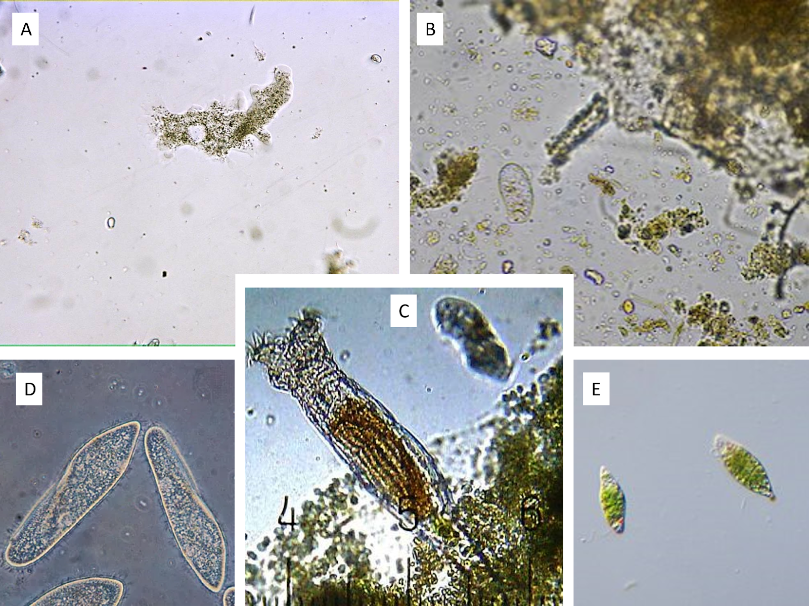 common pond microorganisms